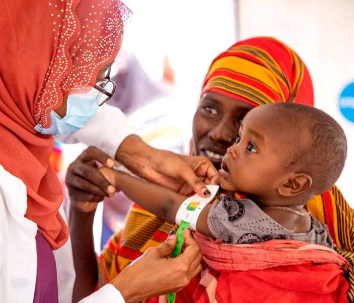 Blog sobre la desnutrición y sus características | UNICEF